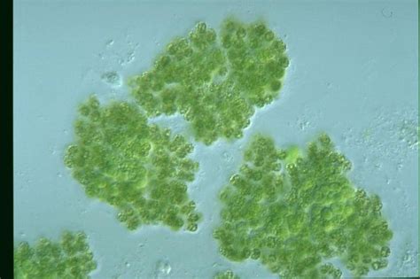Microcystis Sp Green Algae Under Microscope