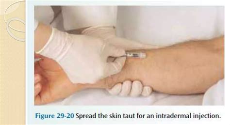 Administering An Intradermal Injection Pptx