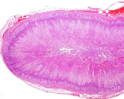 Adrenal Gland Cortex And Medulla Photograph By Science Photo Library Pixels Merch