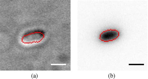 Validation Dic Vs Fluorescence Comparison Between Segmentations Of