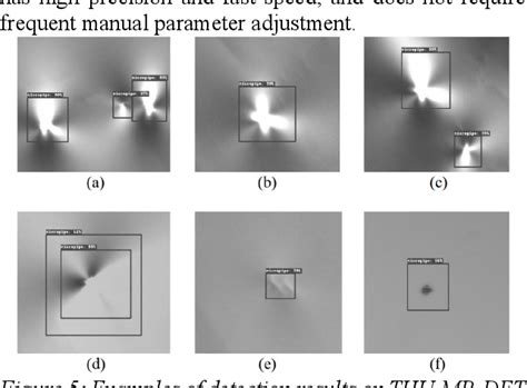 figure 2 from an end to end detection approach for micropipe defect of