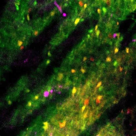 Neurons Responsible For Orchestrating Habitual Behavior Identified Neuroscience News