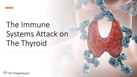 Thyroid Immune System
