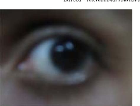 Figure 1 From An Effective Method For Iris Recognition Based On Discrete Cosine Transform