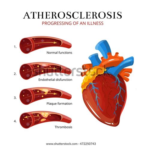 Best Endothelial Function Royalty Free Images Stock Photos Pictures Shutterstock