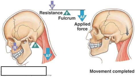Musculoskeletal Joint Classifications Flashcards Quizlet