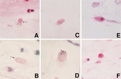 Iron Hematoxylin Staining Method Semantic Scholar