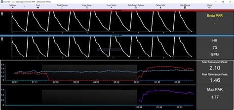 Endothelial Function Testing Vicorder Smart Medical