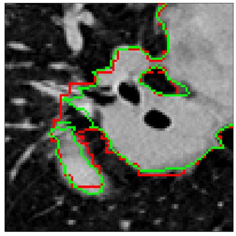 Comparison Of The Expert Interpolated Markup In Red With Model Download Scientific Diagram