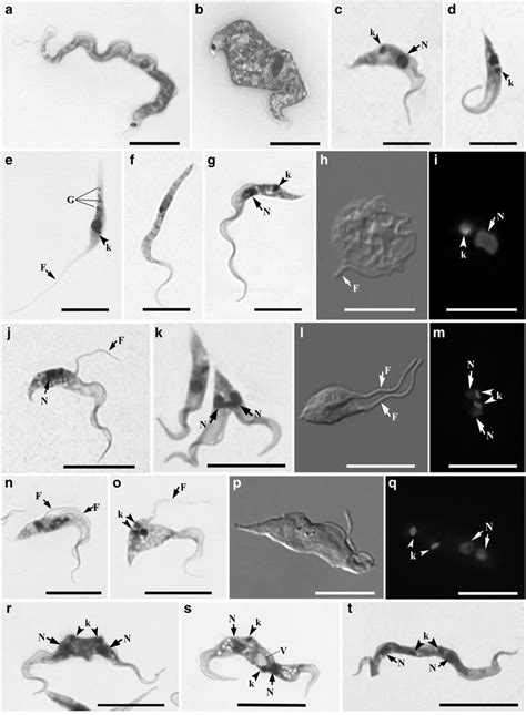 Light Microscopy Analysis Of Trypanosoma Abeli N Sp Cultured In