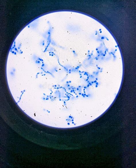 Fungal Spores Under A Microscope Stock Image Image Of Microscope