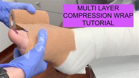 What To Use For Compression Wrap At Charles Herald Blog
