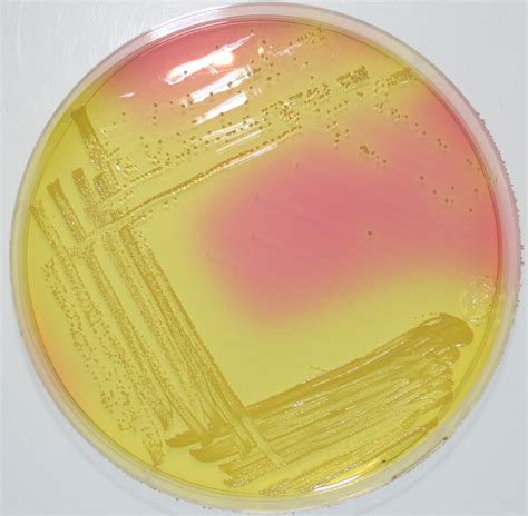 Staphylococcus Aureus Agar