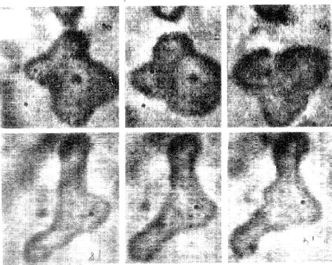 Transient Shapes Of Vesicles Of Dmpc Containing 2 Mol Of The Bipolar