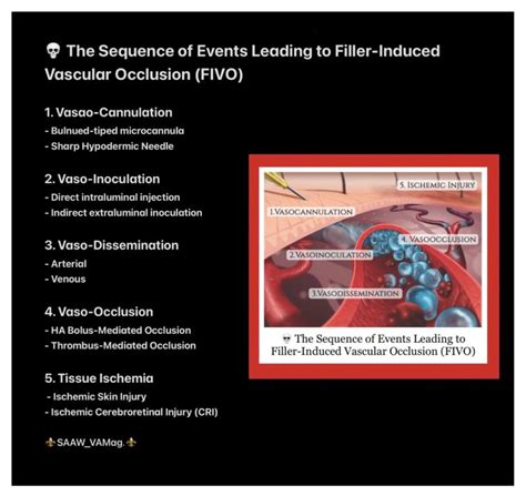 💀 The Sequence Of Events Leading To Filler Induced Vascular Occlusion Fivo 1 Vasao
