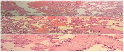 Journal Of Clinical Images And Medical Case Reports