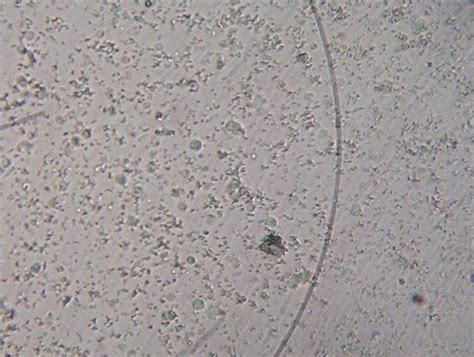 Microphotograph Of Urinary Sediment Of 5 Years Old Male German Shepherd