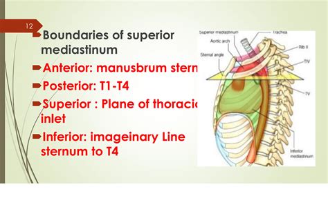 Radiological Anatomy Of The Mediastinumpdf