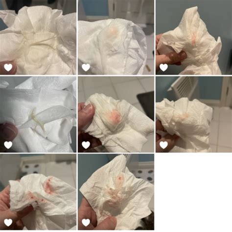 Implantation Bleeding Look Like