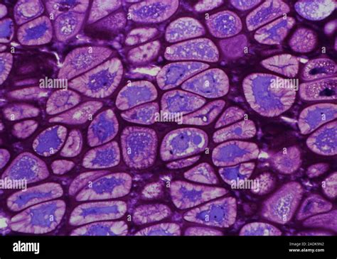 Hyaline Cartilage Light Micrograph Of A Section Through Hyaline