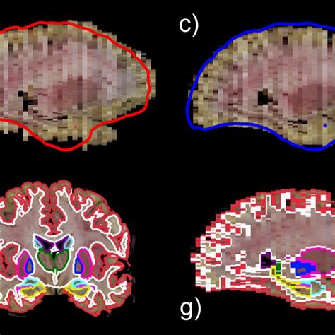 Demonstration Of 3d Reconstruction And Segmentation With A Hard Download Scientific Diagram