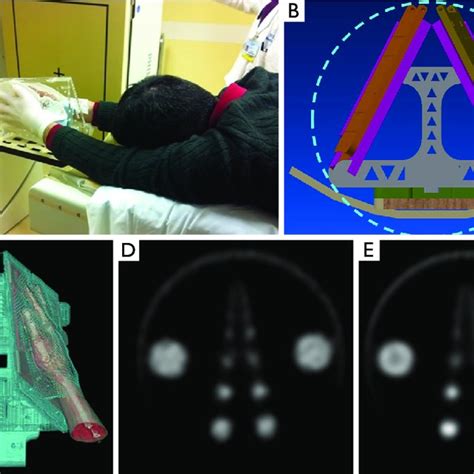 Spect Ct Imaging Protocol Development A B C The Immobilization Download Scientific Diagram