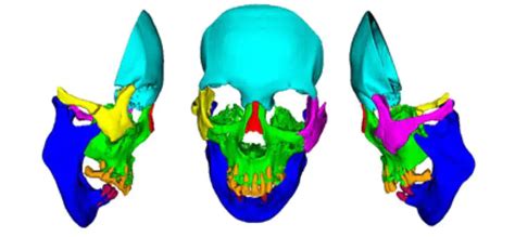 Deep Learning Based Automatic Facial Bone Segmentation Using A Two Dimensional U Net Mazen Soufi