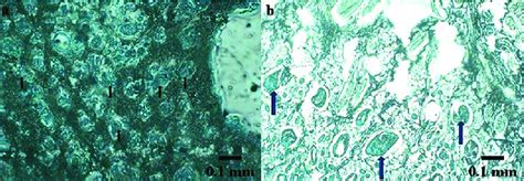 Histologic Presence Of Superparamagnetic Iron Oxide Nanoparticles Can Download Scientific