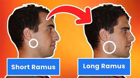 The High Importance Of The Ramus For The Jaw Blackpill Anaylsis
