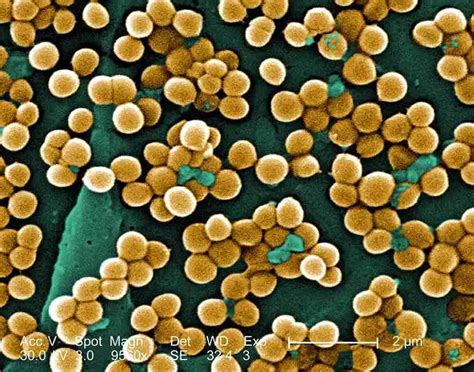 What Antibiotic Treats Staph Aureus