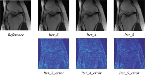 Representative Visual Results Of Different Iterations In The Same