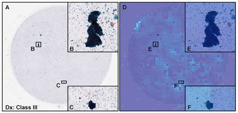 Representative Example Of False Negative Prediction A Representative