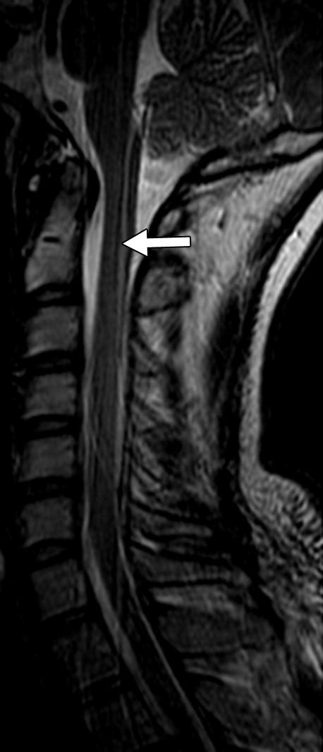 Application Of Basic Physics Principles To Clinical Neuroradiology