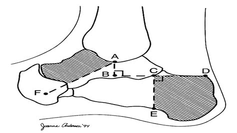 External Fixation Of The Calcaneus And Talus An Anatomical Journal Of Orthopaedic Trauma