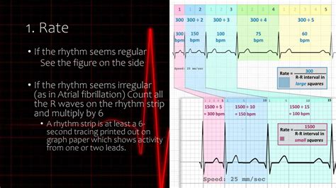Basic Ecg Interpretationpptx