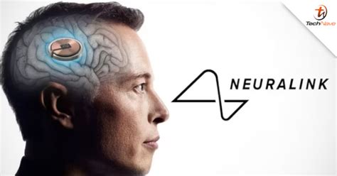Elon Musk The First Human Implanted With A Neuralink Chip Has