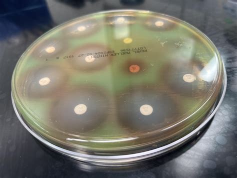 Merry Christmas Pseudomonas Aeruginosa R Medlabprofessionals