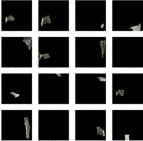Figure 1 From An Ai Decision System To Predict Lung Nodules Through