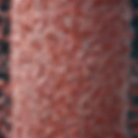 Understanding Iga Lambda Monoclonal Band Analysis And Implications Understanding Iga Lambda Monoclonal Band Analysis And Implications