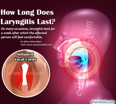 How Long Does Laryngitis Last And How To Get Rid Of It Quickly