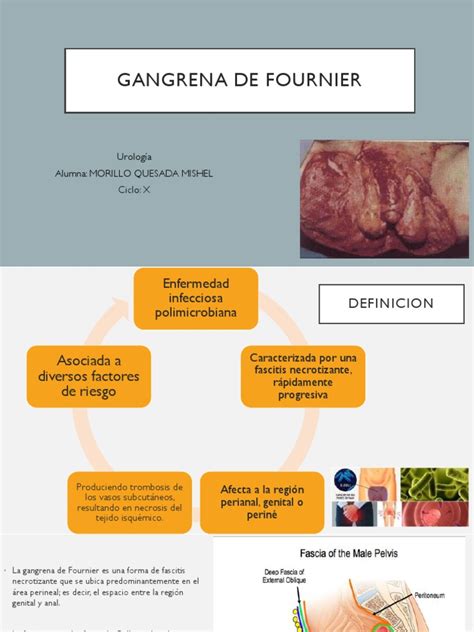 Gangrena De Fournier Definición Y Tratamiento Pdf Especialidades Medicas Ciencias De La Salud