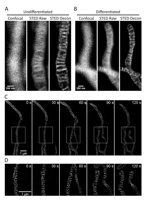 Video Author Spotlight Decoding Mitochondrial Aging