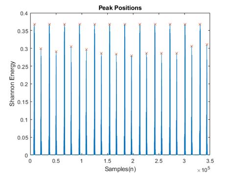 Segmentation Of Heartbeat Sounds Using Shannon Energy Envelopes Adithya Narayan