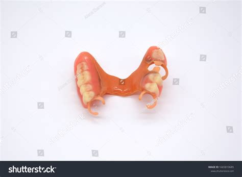 Removable Partial Dentures Upper Lower Jaw Foto Stock 1665810685 Shutterstock Removable Partial Dentures Upper Lower Jaw Foto Stock 1665810685 Shutterstock