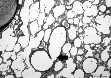 Lung Of The Pouch Young Thylacine With A Range Of Different Sized