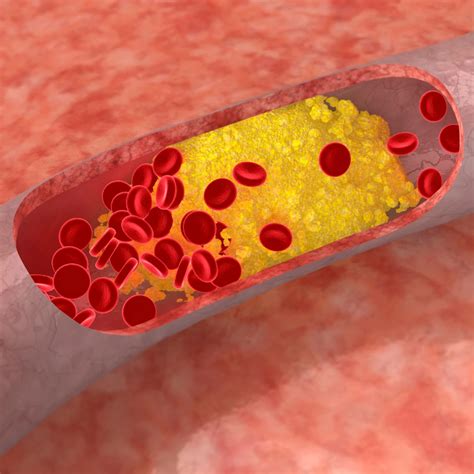 Hdl Cholesterin Alles über Hdl Cholesterin Vaud
