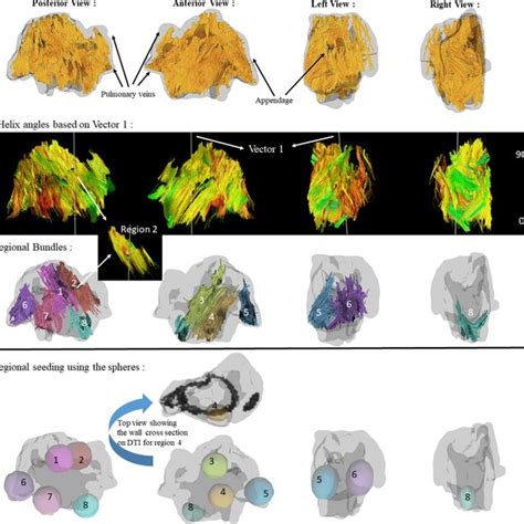 Dti Based Fiber Orientation A Different Views Of The Left Atrium In Download Scientific