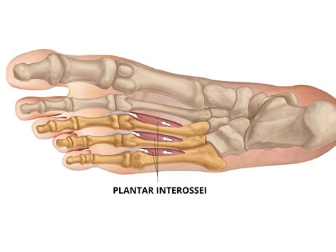Plantar Interossei Of Foot Moho