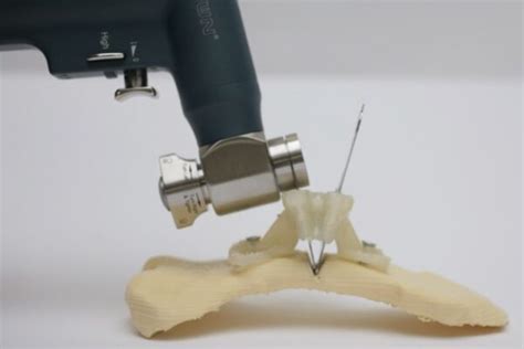 Ravitch Procedure Dr Pectus