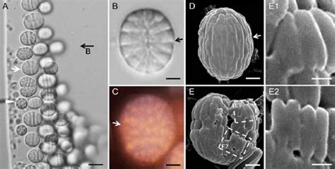 Morphology And Structure Of The Novel Ellipsoidal Mmps A The
